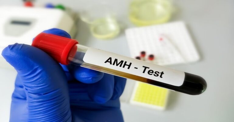 IVF With Low AMH? Possible Or Not