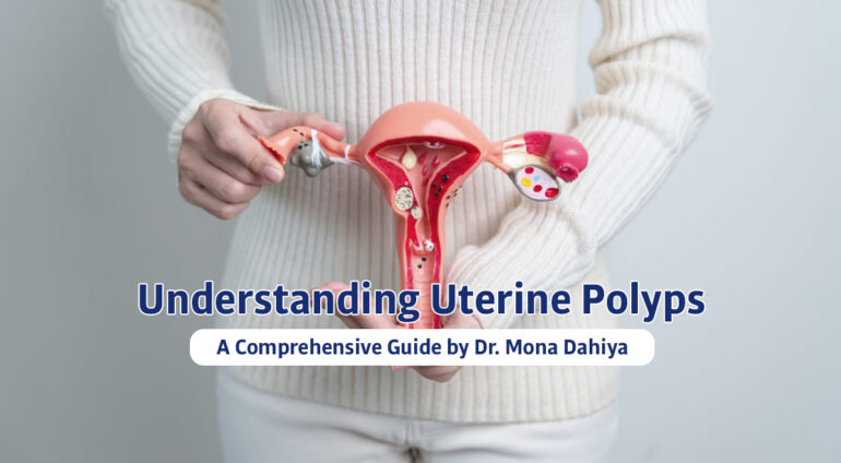 Understanding Uterine Polyps: A Comprehensive Guide by Dr. Mona Dahiya