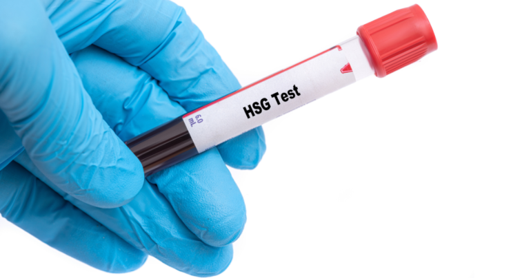 Everything you should know about the HSG test | Dr. Mona Dahiya